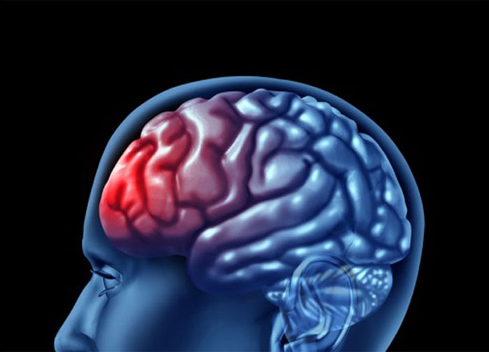 New AI model helps assess brain injury in patients